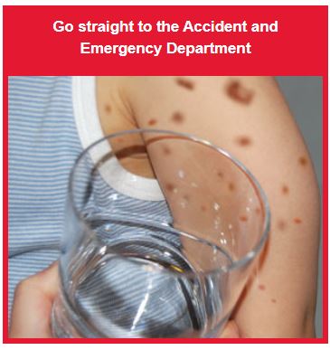 Meningitis & sepsis – More serious illnesses – Newham Council